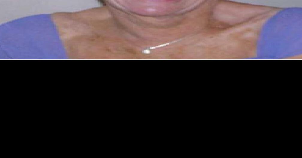 Ruth Candace Prossner | Obituaries | stardem.com