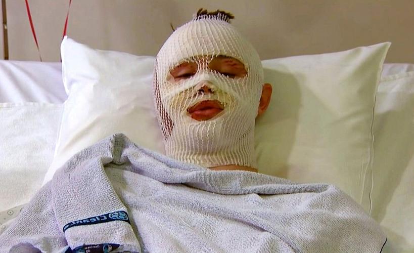 Former Santa Clara man who survived 2 terrorist bombings has ‘chosen to ...