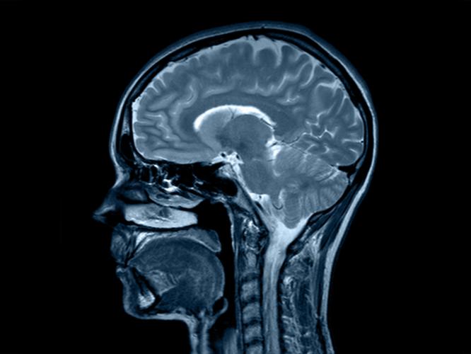 New study seeks to explain the ‘Mandela Effect’ – the bizarre ...