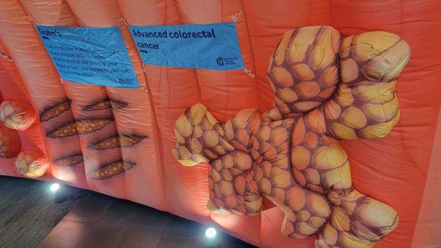 Inflatable colon display traveling through Southern Utah sheds light on ...
