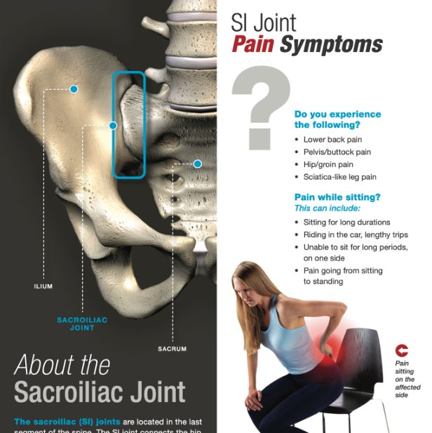 si joint dysfunction symptoms