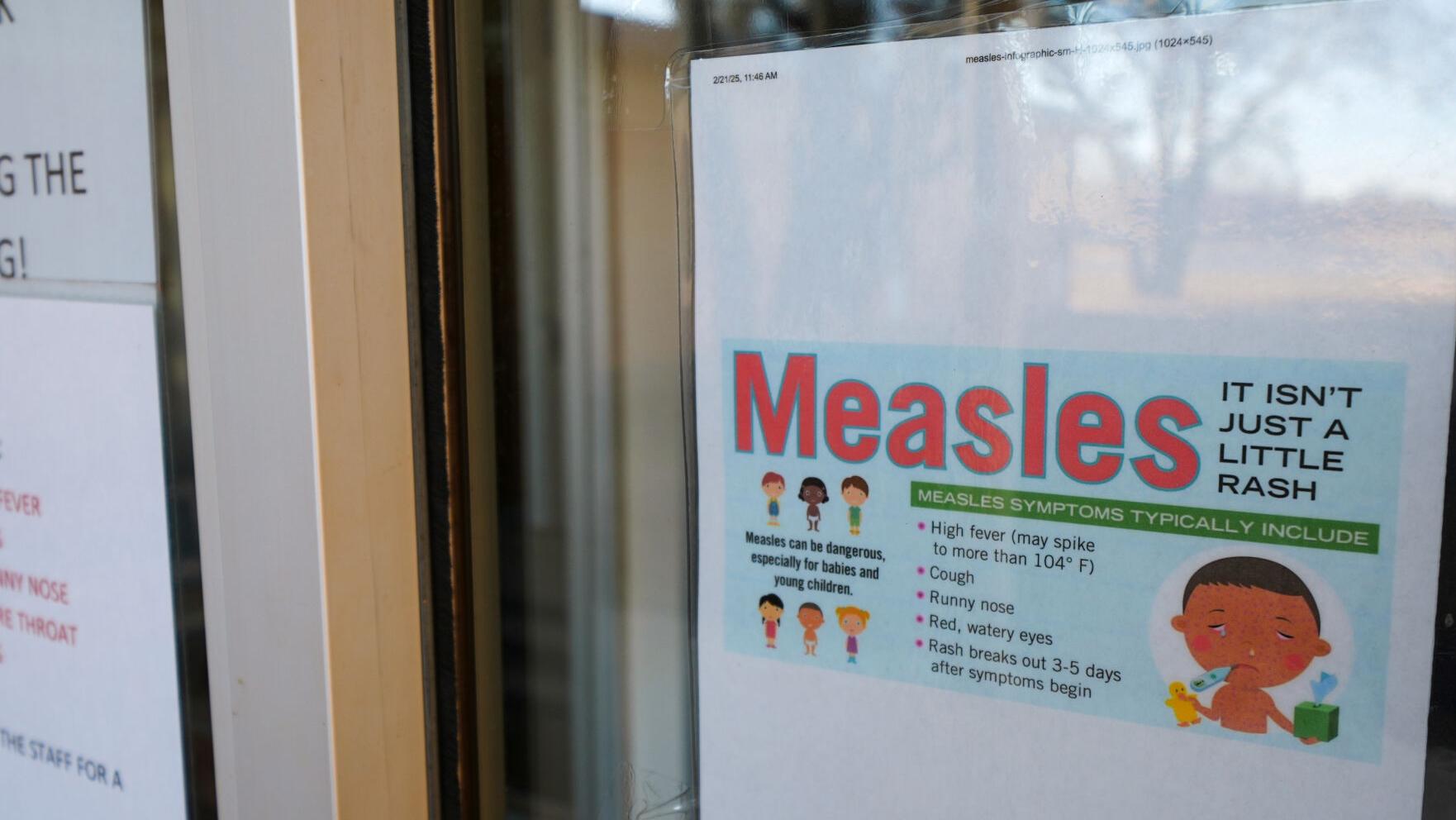 Measles cases increase in Utah, South Carolina, Arizona; nation's ...