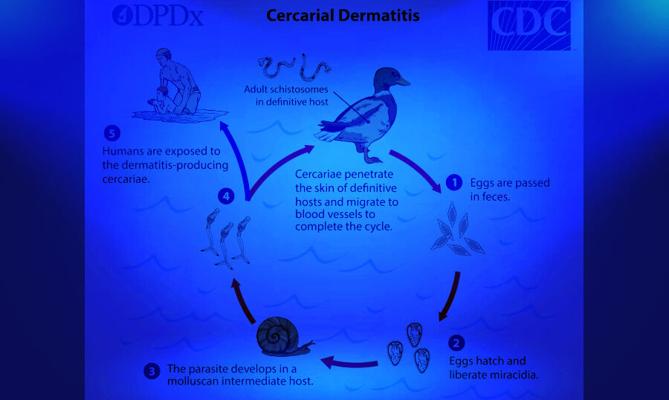 Parasite causing swimmer’s itch returns to Sand Hollow. What can you do ...