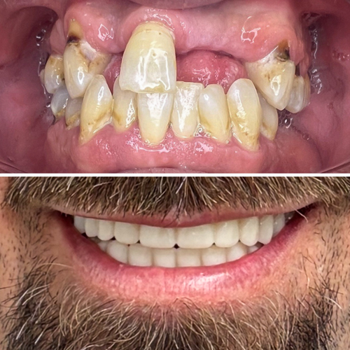 Transforming smiles: Dr. Shawn Davis offers revolutionary Teeth in a ...
