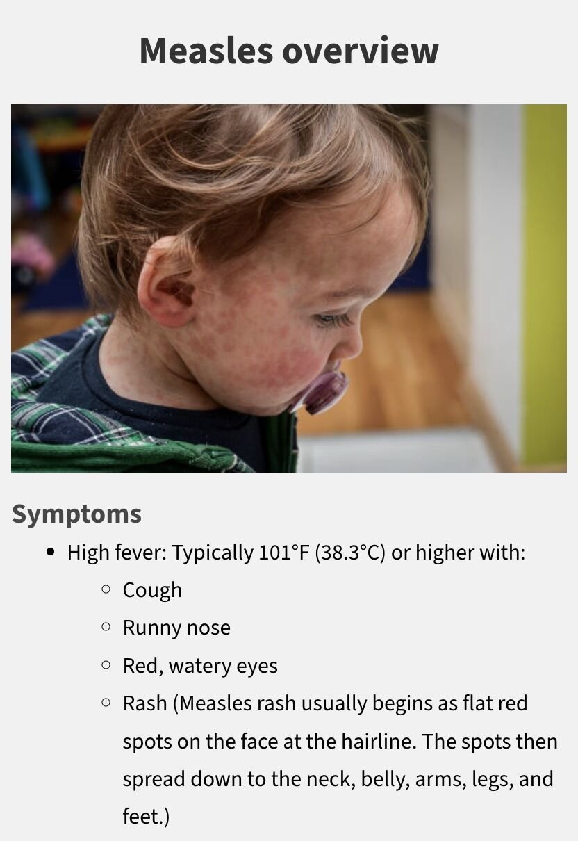 Measles cases increase in Utah, South Carolina, Arizona; nation's ...