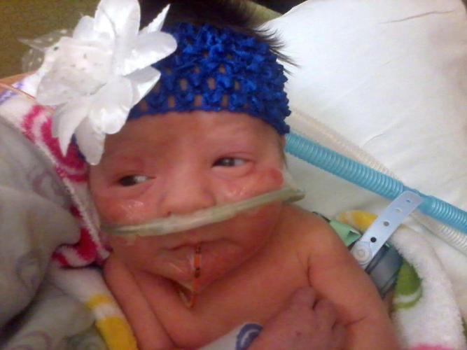 Ivins mom struggles to support baby girl with clubfoot; how you can ...