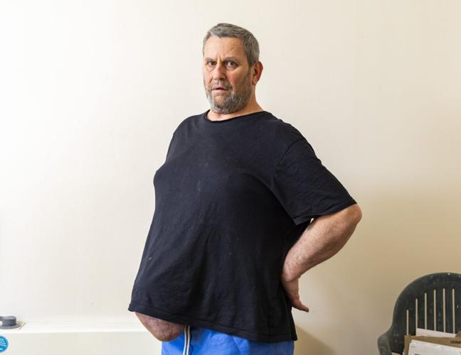 Man fundraising for surgery to remove watermelon-sized mass | Health ...