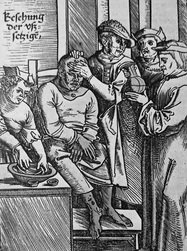 Was leprosy a social death sentence during medieval times? | Health ...