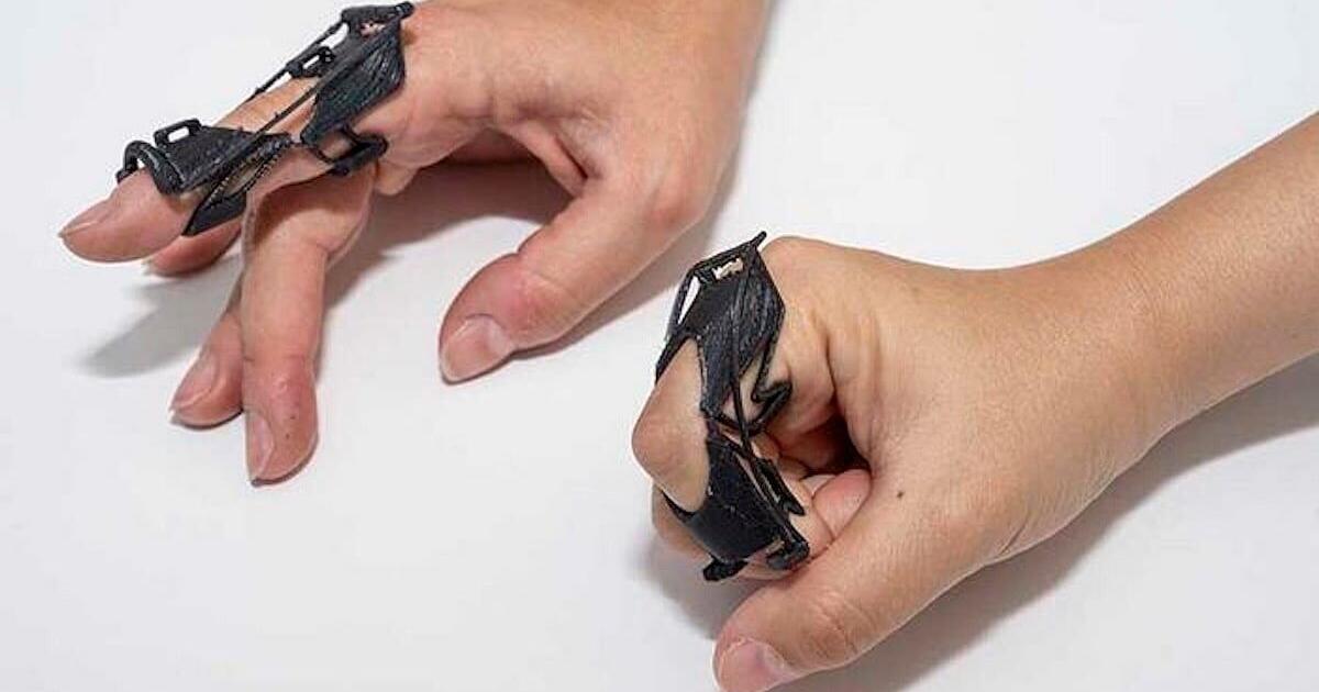 Customizable Finger Brace Eases Rehab, Arthritis Care | Nation | swiowanewssource.com