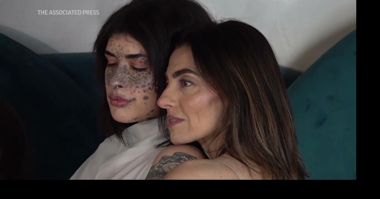 Imperfect beauty takes off in Italy | | swiowanewssource.com