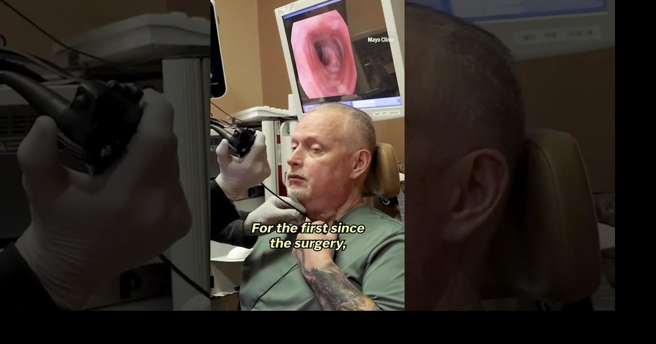A rare voice box transplant helps cancer patient speak again ...