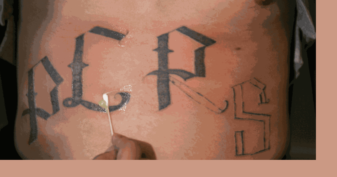 How a gang tattoo removal program is helping people start fresh | News ...