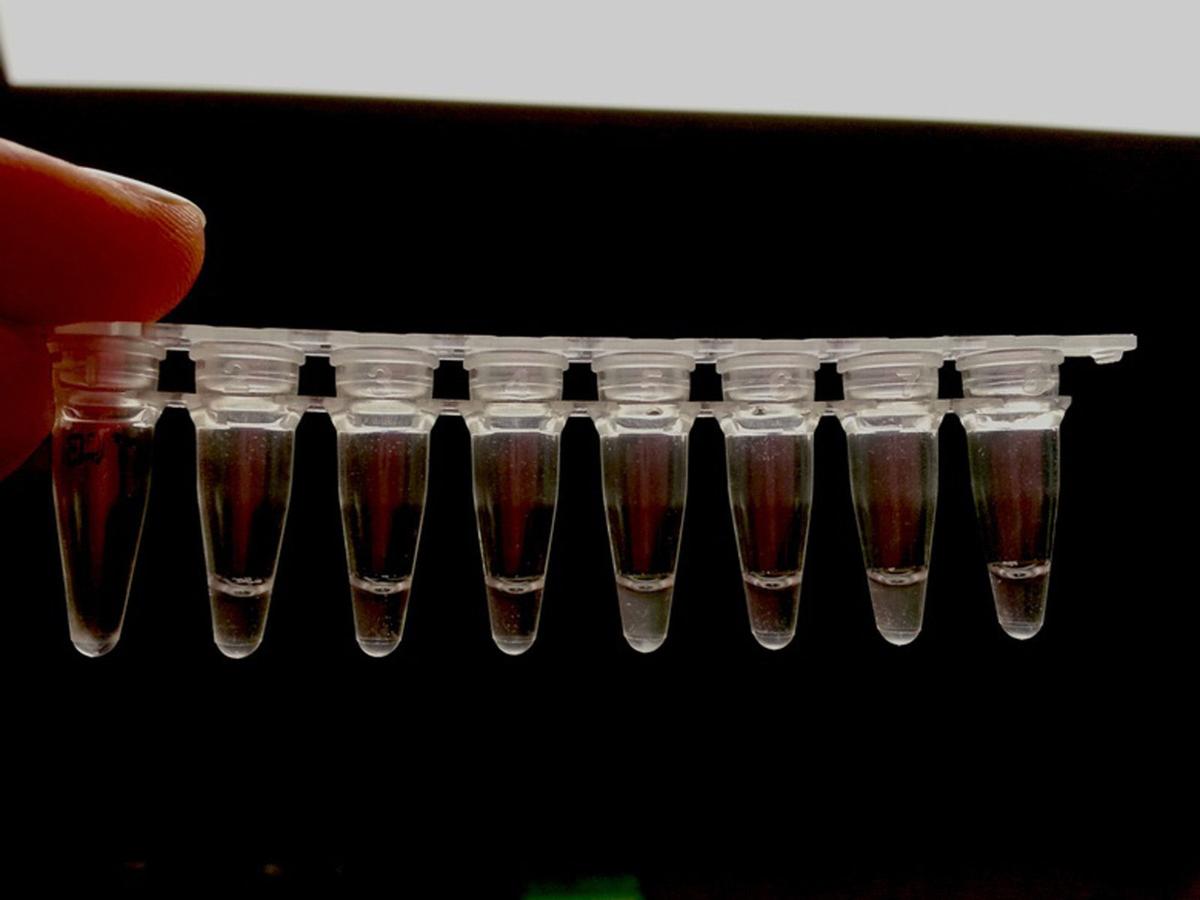 Seattle health startup speeds up lab tests to improve use of antibiotics