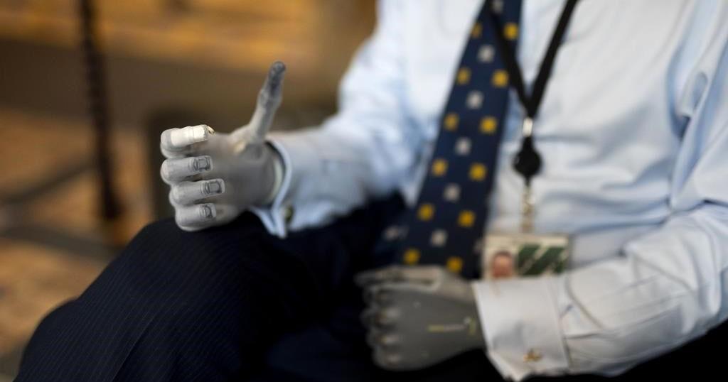 UK lawmaker who wanted to be known as the 'bionic MP' says he has ...