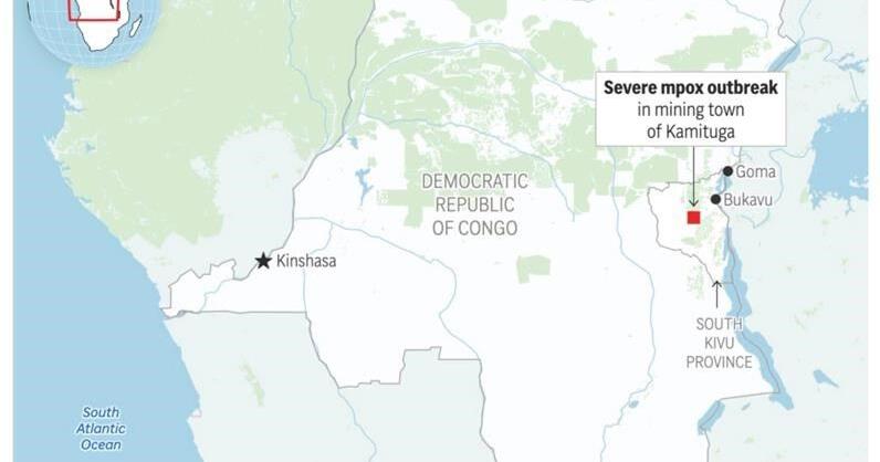Why is Congo struggling to contain mpox? | Health News ...