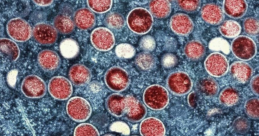 WHO renames monkeypox as mpox, citing racism concerns | Health News ...