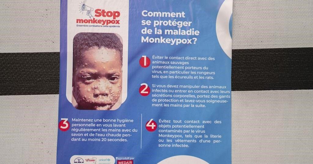 Sweden reports 1st case of more infectious form of mpox first ...