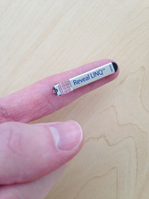 Blount Memorial Hospital patient receives cardiac monitoring device ...