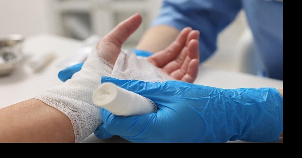 What rights do you have when insurance denies burn claims?