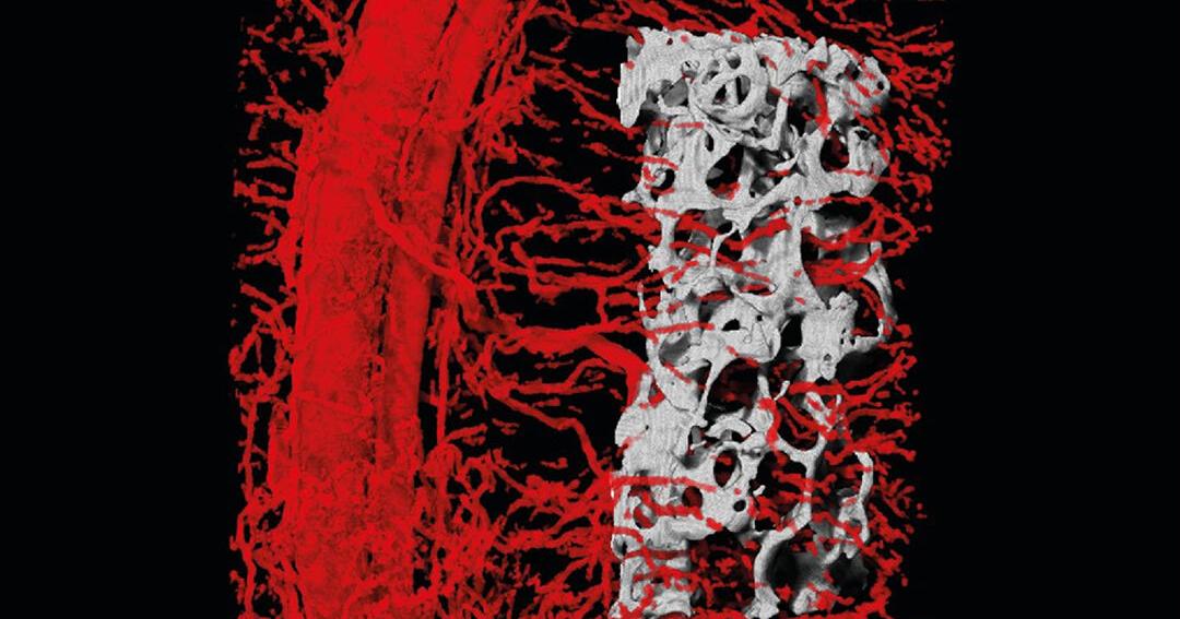 Growing Bone in a Lab? New Advances From the Technion Prove it’s ...