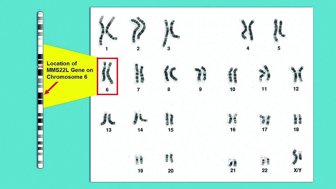 Study Suggests Genetic Mutation in Some Ashkenazi Jewish Men May Be ...