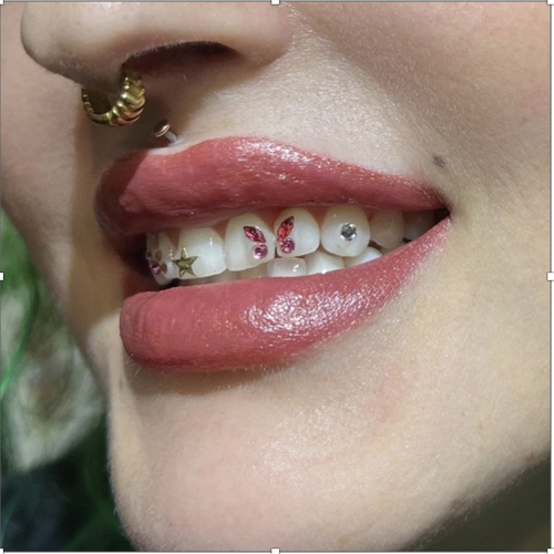 tooth piercing gum