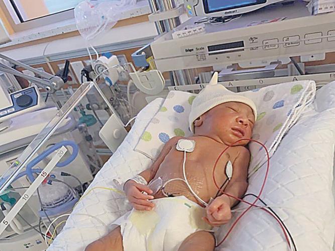 Life-saving surgery for baby born with rare condition | News ...