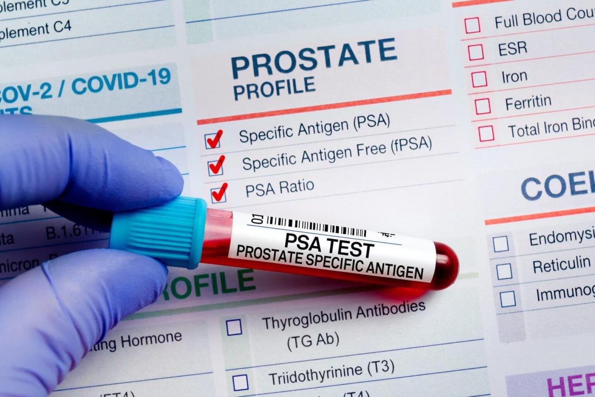 Before prostate cancer speaks, PSA often whispers | Lifestyles ...