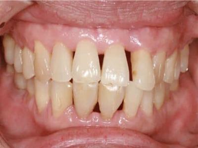 How a periodontist manages gum diseases | The Specialist ...