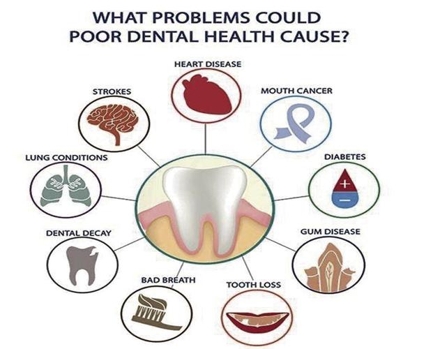 The relationship between dental health and overall health | The ...