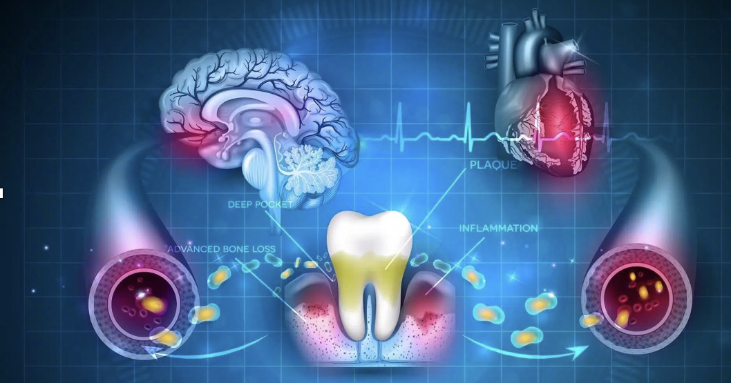 The oral-systemic health connection: Your mouth and your overall well ...