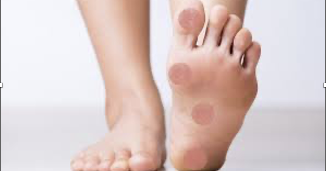 How to prevent back-to-school foot pain | Lifestyles ...