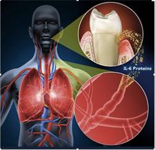 Healthy gums, healthier lungs: The hidden connection | Lifestyles ...