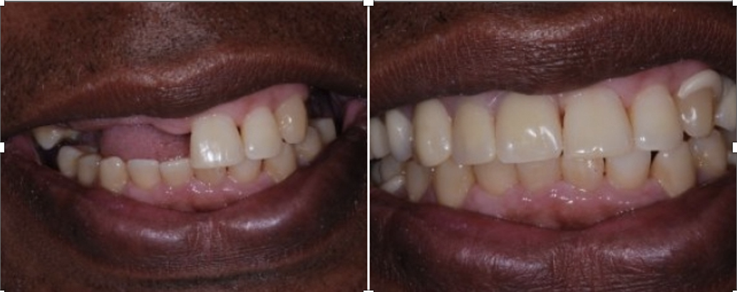 The consequences of dental neglect | The Specialist | thenassauguardian.com
