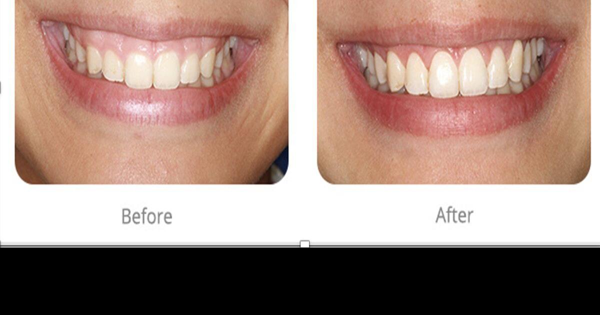 Innovations in gum disease treatment | The Specialist ...