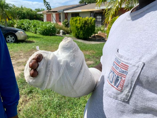 Fisherman on GB had to pull his hand out of the jaw of a shark | News ...