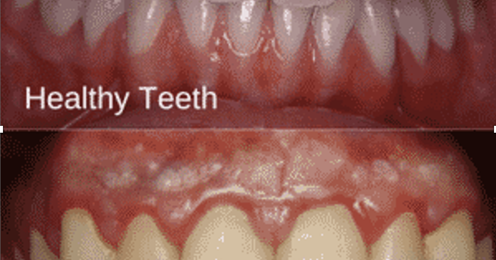 Gum disease risks and prevention | The Specialist | thenassauguardian.com