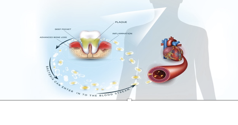 Gum disease: The silent threat to overall wellness | The Specialist ...