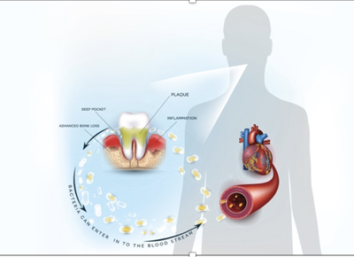 Gum disease: The silent threat to overall wellness | The Specialist ...