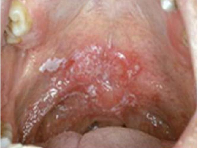 does smoking affect your palate