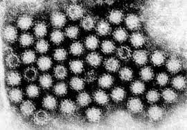 ASTROVIRUS: Source of sickness identified | News | thenewsguard.com