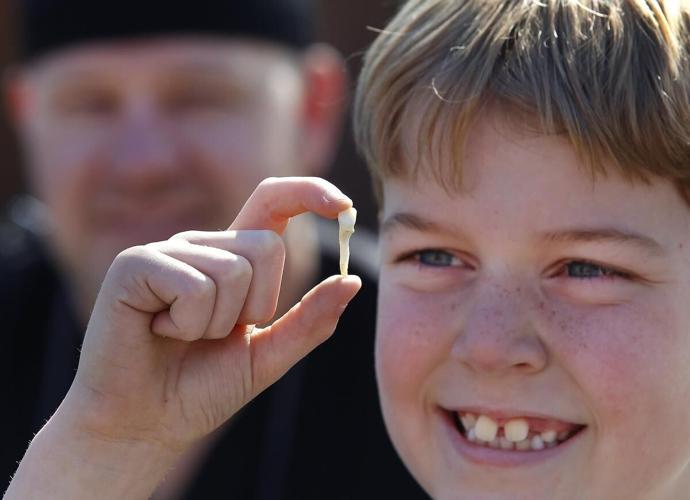 Peterborough boy sets Guinness World Record for longest milk tooth