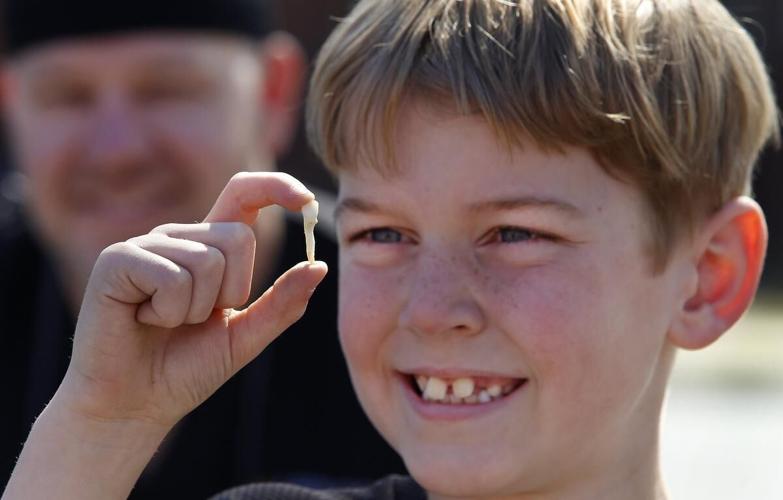Peterborough boy sets Guinness World Record for longest milk tooth