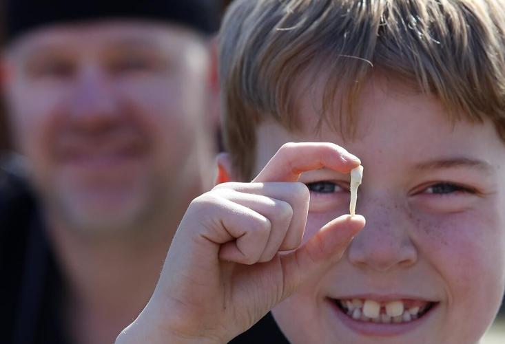 Peterborough boy sets Guinness World Record for longest milk tooth