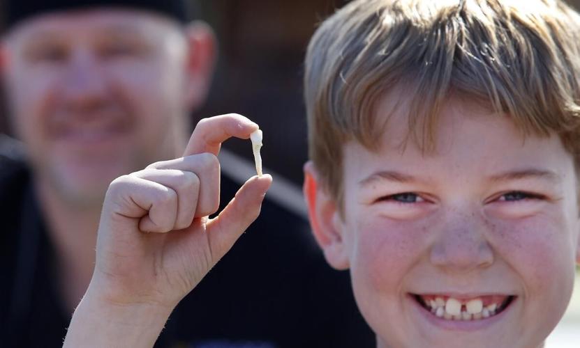 Peterborough boy sets Guinness World Record for longest milk tooth