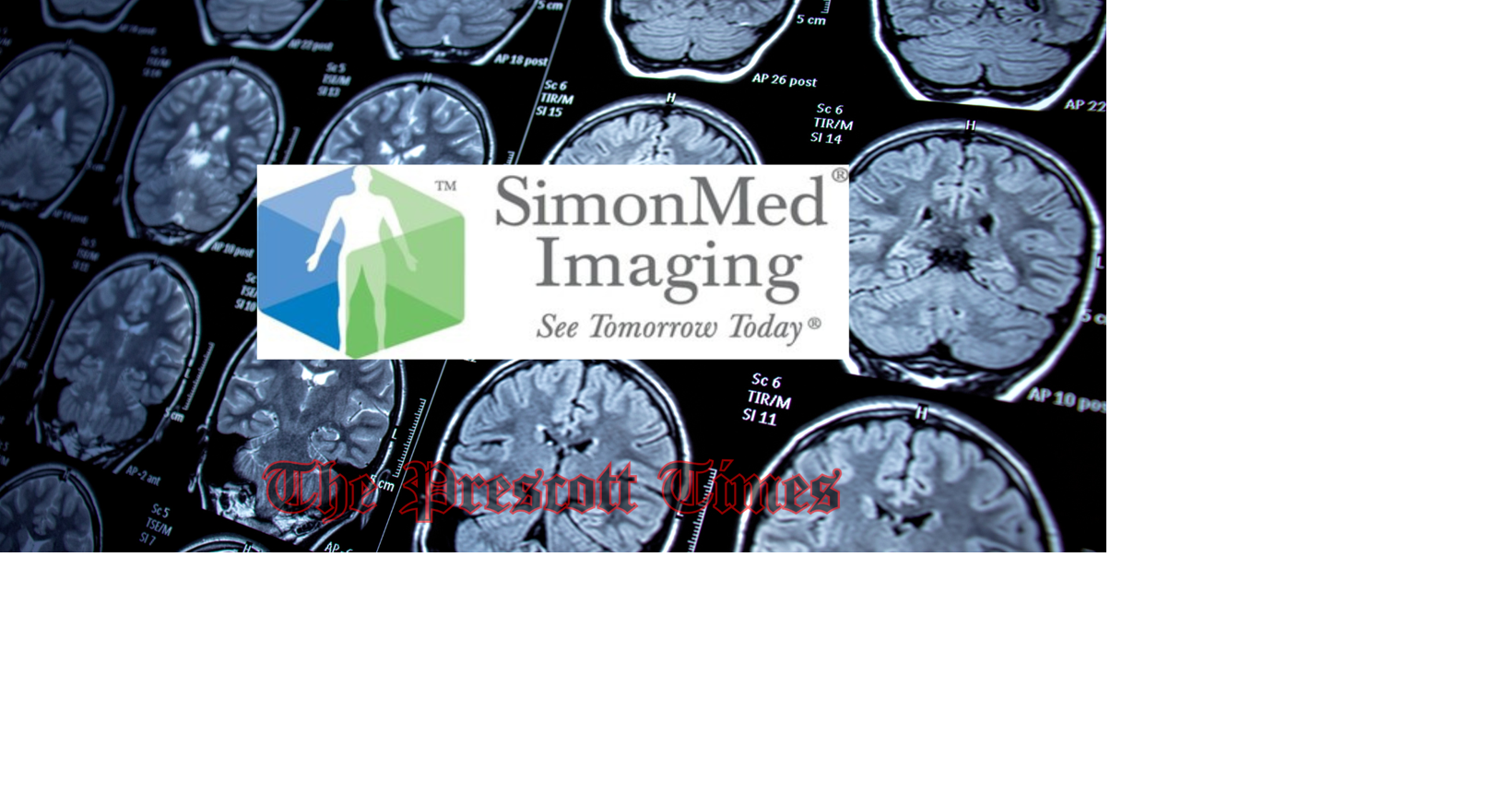 SimonMed Announces First Outpatient Imaging Center Installation in ...