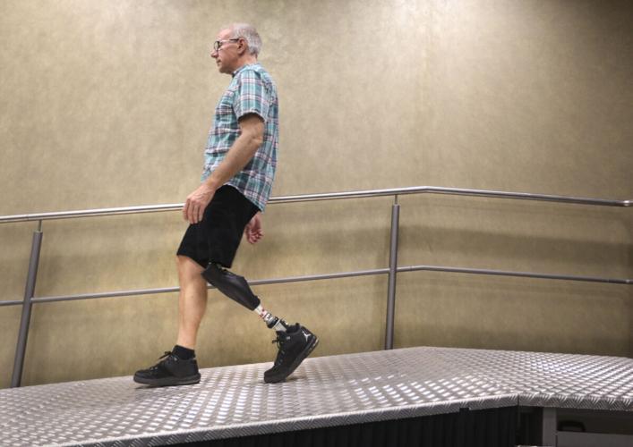 Top-of-the-line prosthetic devices have improved by leaps and bounds