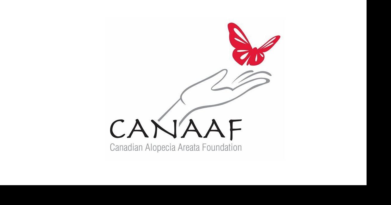 First alopecia areata support group launches in Waterloo
