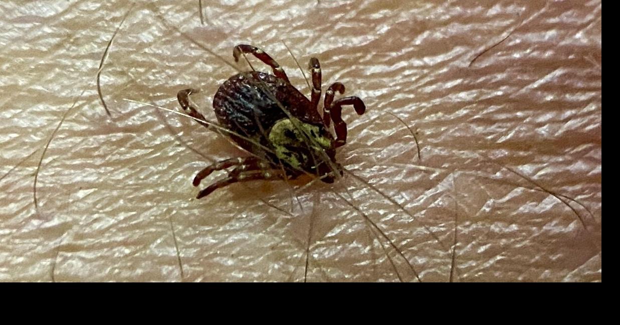 Outside: Ticks can cause lots of health issues | Sports ...