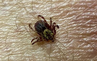 Outside: Ticks can cause lots of health issues | Sports ...
